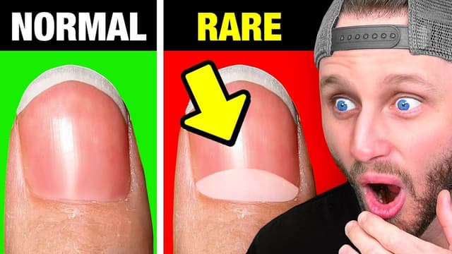 Watch SSundee Reacts S03:E10 - Unique Bodies & How Things Are Made ...