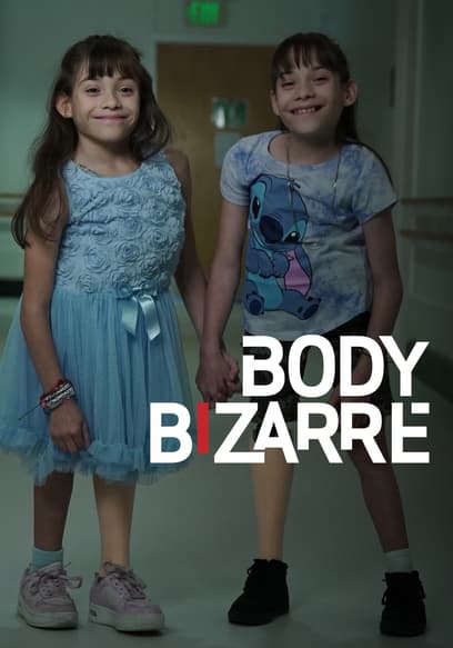 Watch Body Bizarre S06:E07 - My Flesh Is Turning to Bone - Free TV ...
